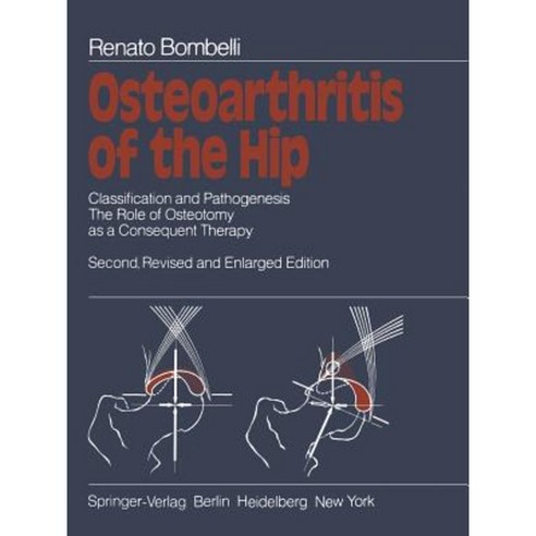 Osteoarthritis of the Hip: Classification and Pathogenesis the Role of ...
