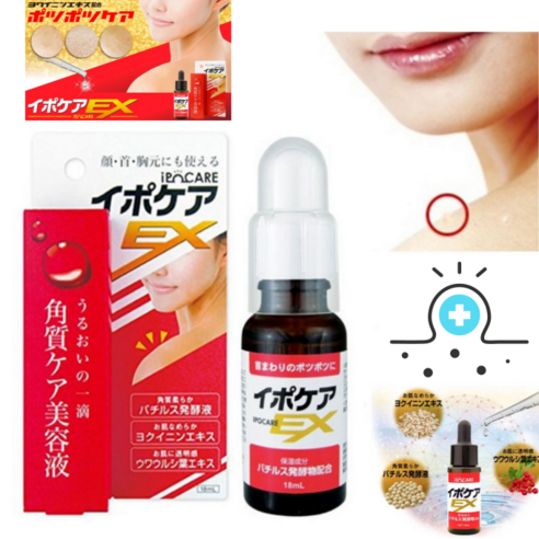 '이뽀케아EX 얼굴 목 어째 각질 제거 크림 연고, 18ml, 1개' 최저가 검색, 최저가 19,140원 - 할인 알림