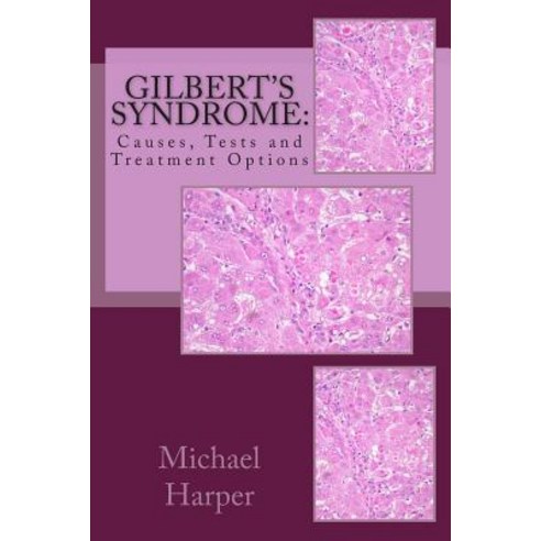Gilbert''s Syndrome: Causes Tests and Treatment Options Paperback ...